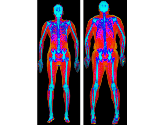 Why Body Fat Percentage is Flawed | London Daily News