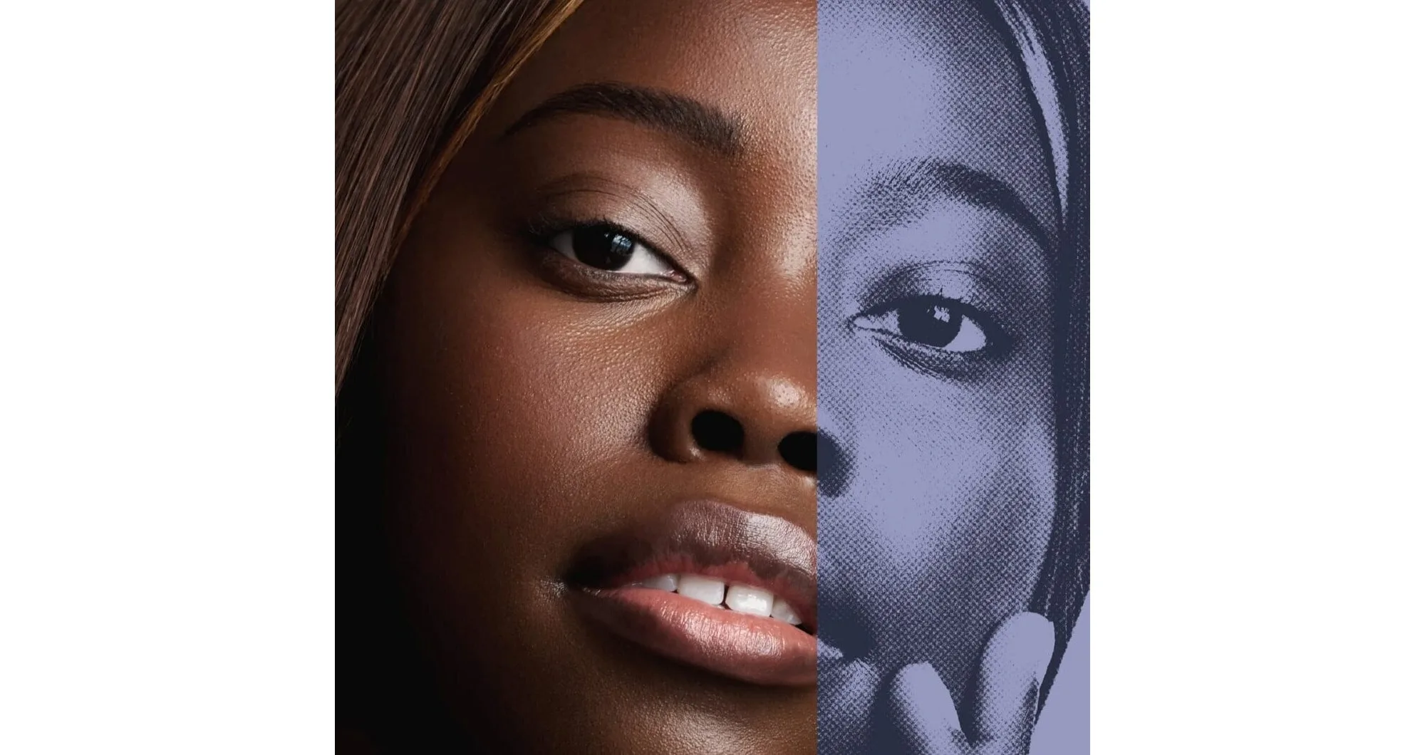 How sensitive skin serum can calm redness and irritation | London Daily ...