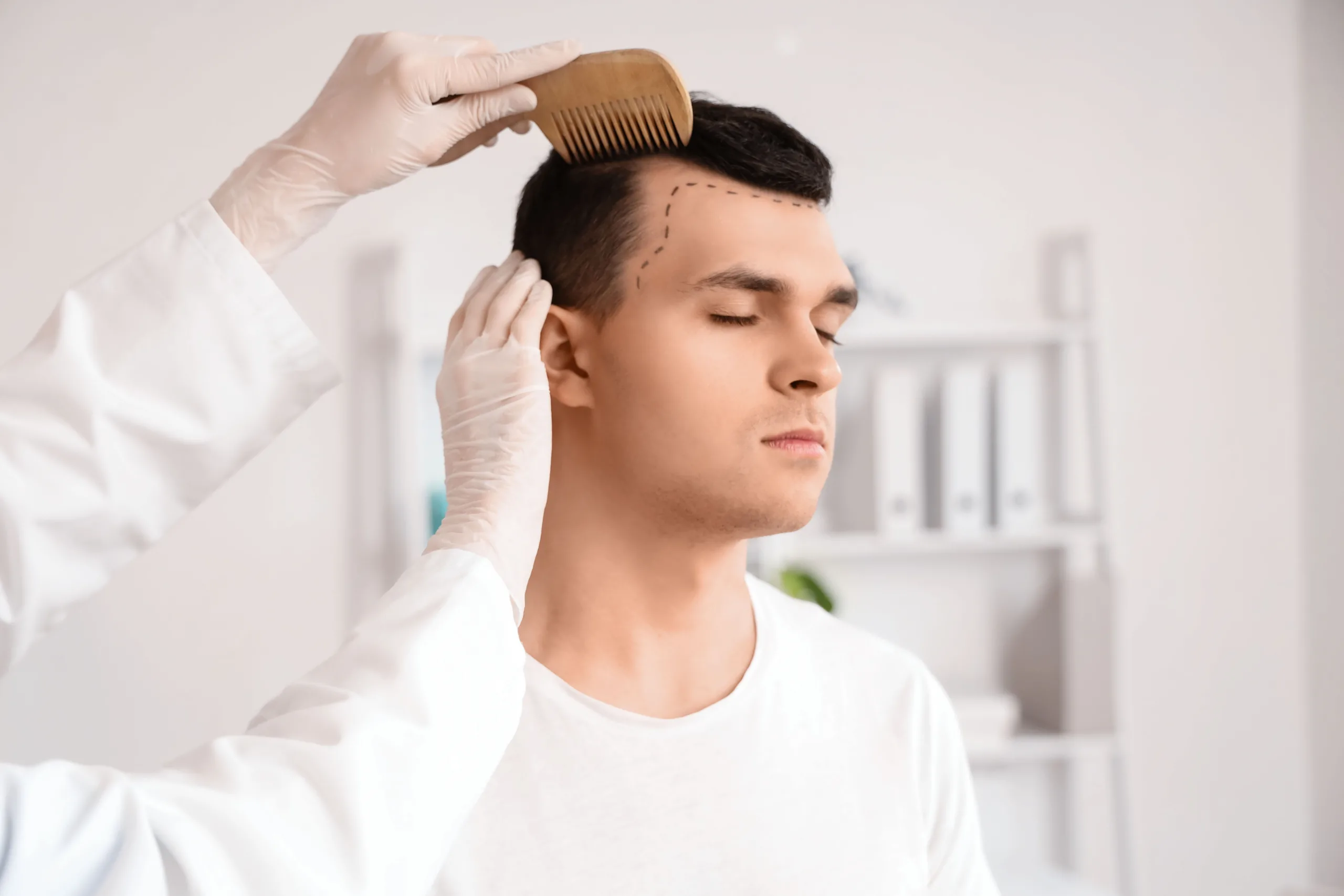Preventative Measures to Fix Male Pattern Baldness.