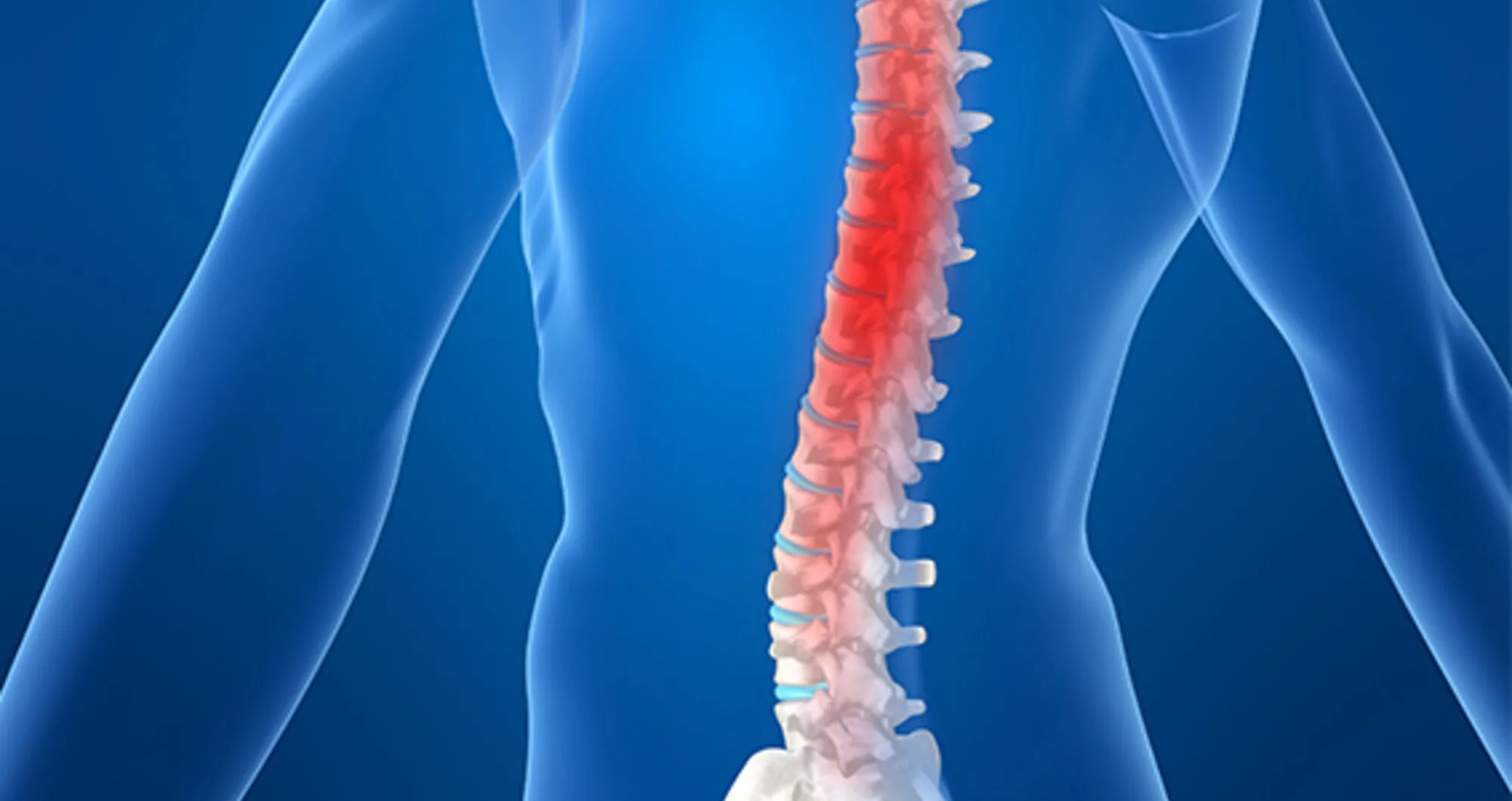 Slipped disc physiotherapy: Best exercises for faster recovery | London ...