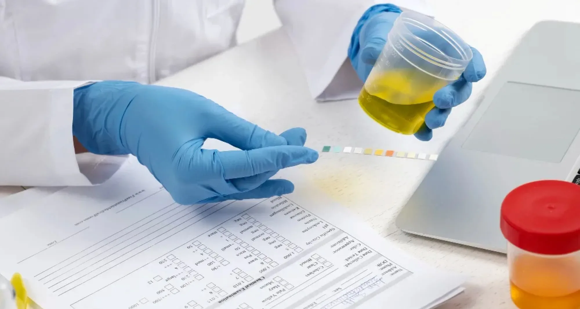 The impact of workplace drug testing on employee health and well-being ...