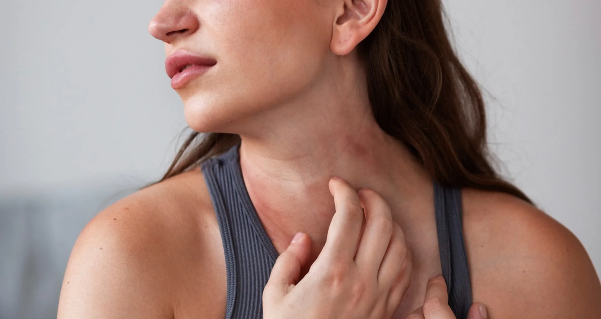 Skin tag causes, risks, and safe removal methods | London Daily News