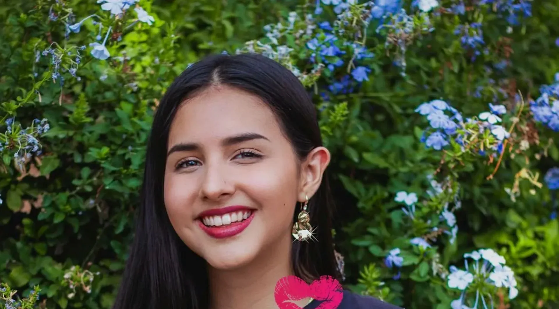 Dental implants: Gold standard for restoring function and confidence ...