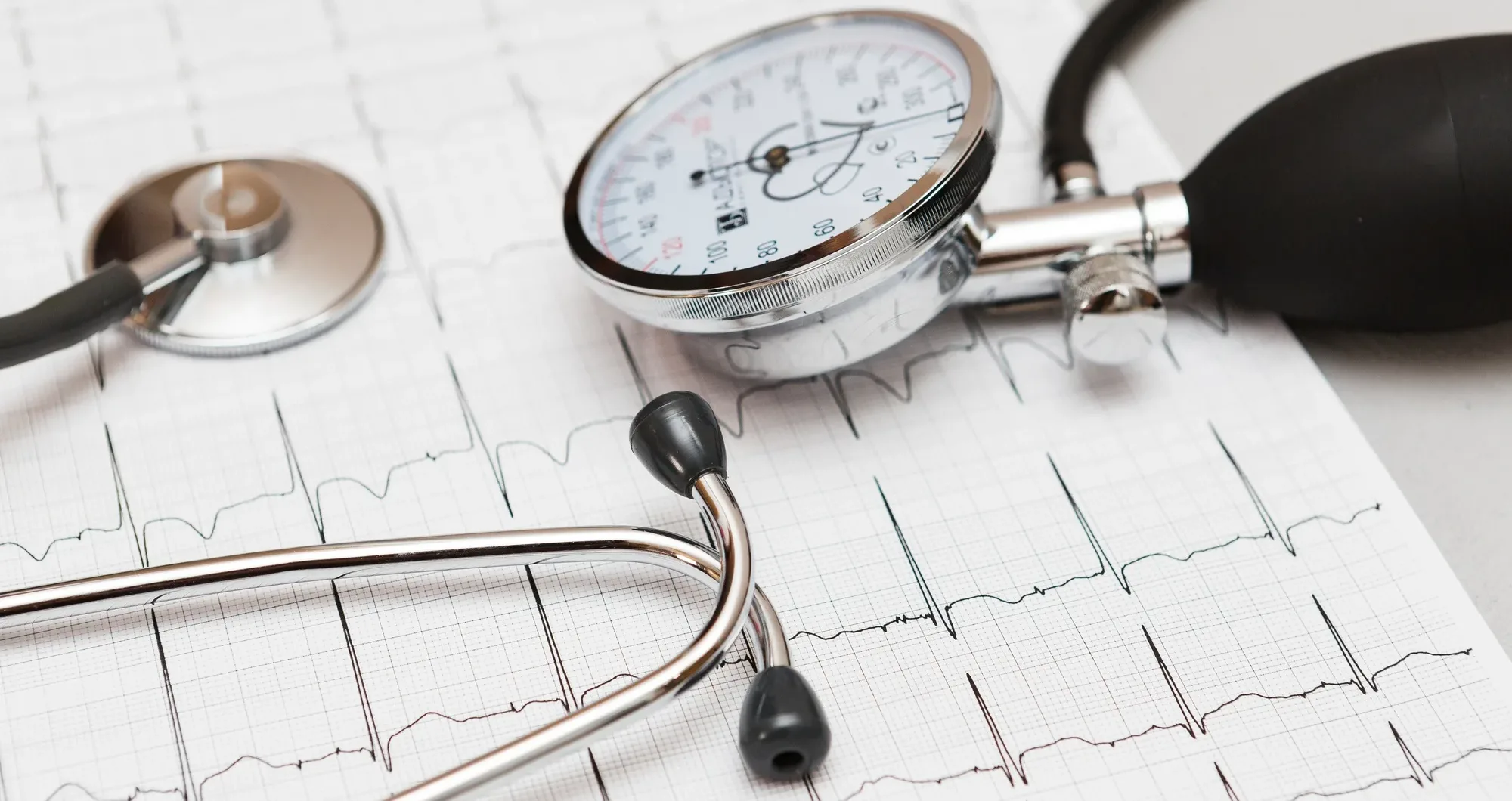 Choosing the right ECG company: A strategic guide for UK healthcare ...