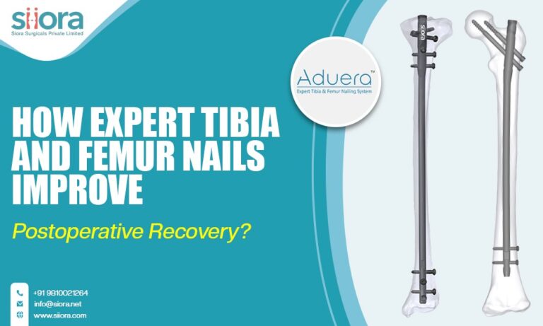 How expert tibia and femur nails improve postoperative recovery ...