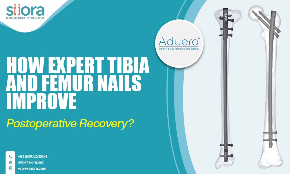 How expert tibia and femur nails improve postoperative recovery ...