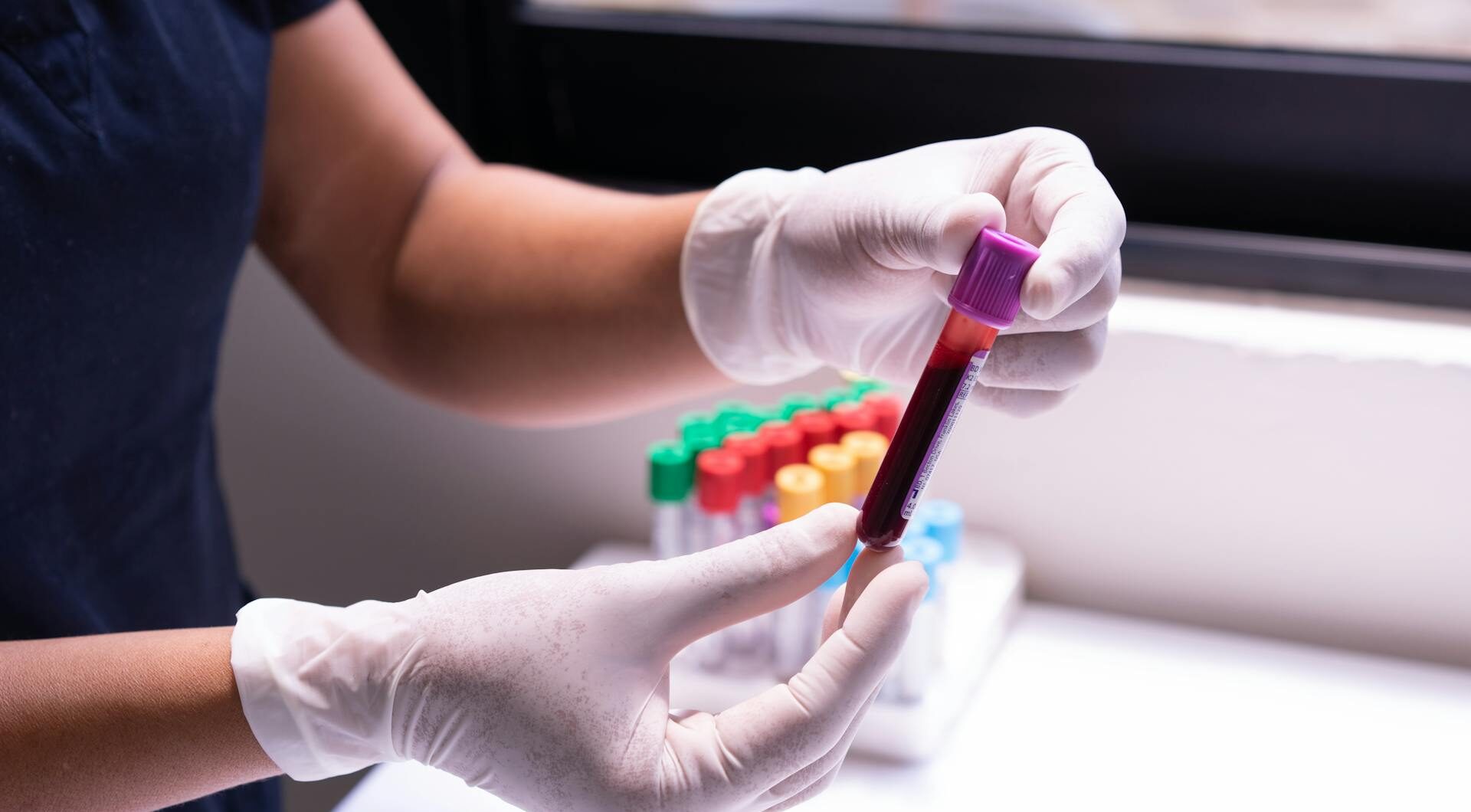 Same-day private blood tests in London: What you can test and how fast ...